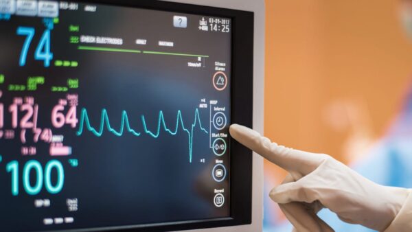 EKG (ECG) - NURSING.com