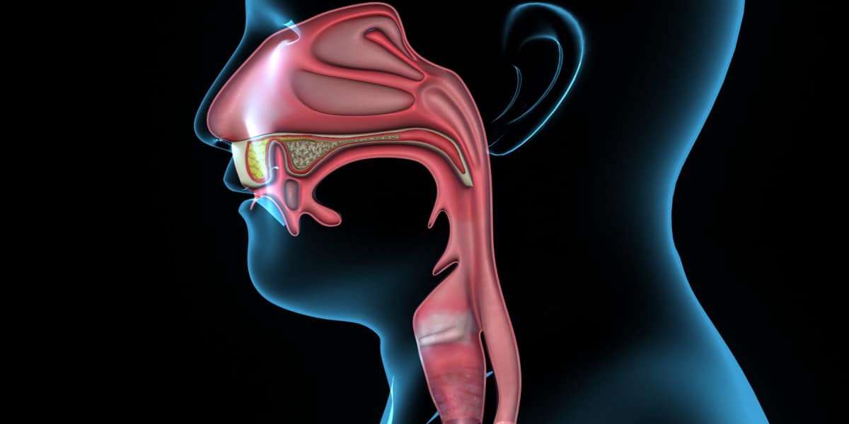 MedSurg | Ears, Eyes, Nose, Throat (EENT) - NURSING.com
